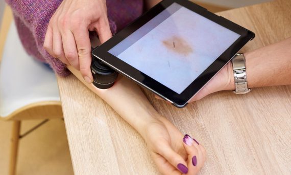 La maladie de Raynaud : symptômes, causes et gestion